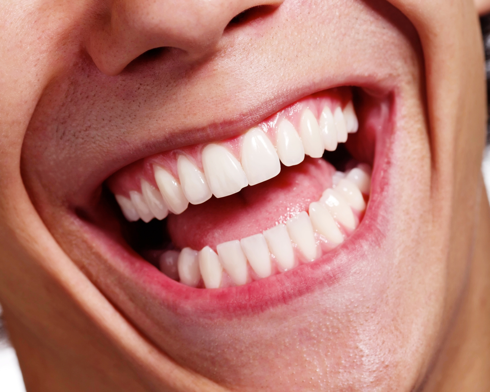 Killer Tips for a Killer Smile | Blog | Coburg Dental Group Killer Tips for a Killer Smile | Blog | Coburg Dental Group